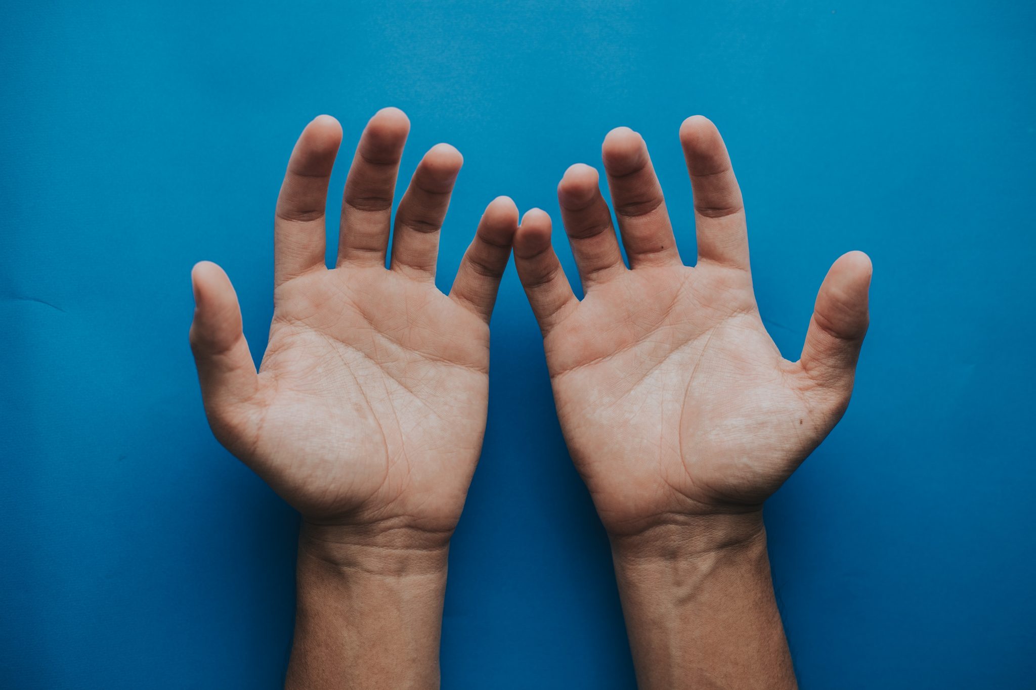 Que faire en cas de plaie de la main ? | Pôle main Bordeaux