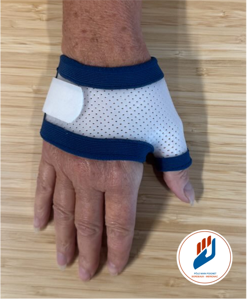 Fracture de la base du premier métacarpien à Bordeaux Mérignac